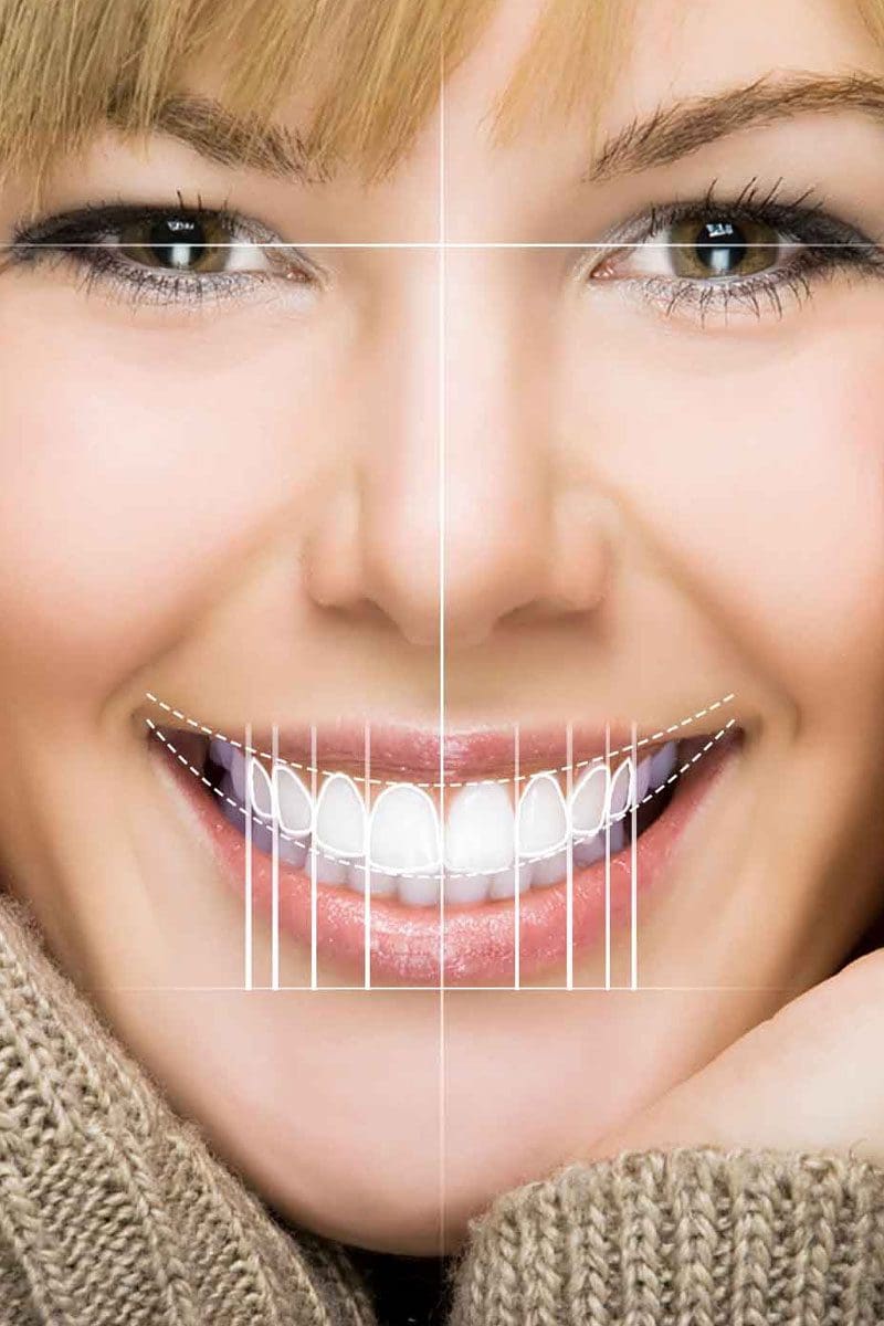 Digital Smile Design | Vogue Dental | Chislehurst Bespoke Dentistry