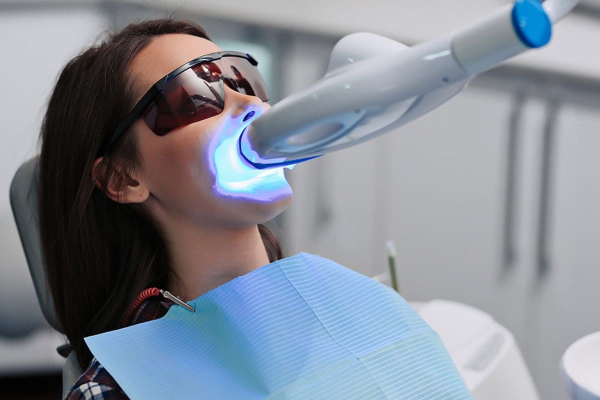 In Chair Power Bleaching | Teeth Whitening | Chislehurst | Bromley