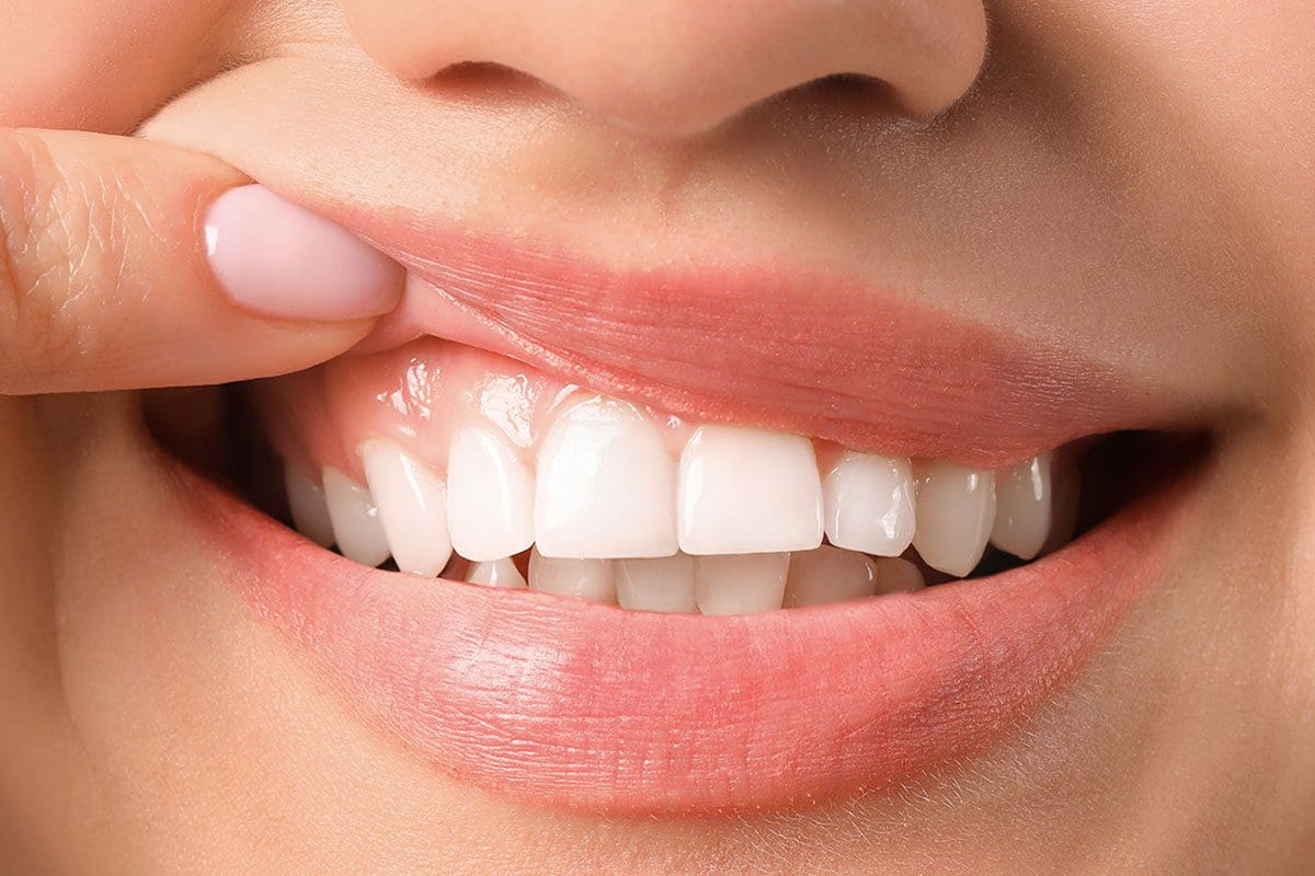 Periodontics | Chislehurst Bromley Kent | Gum Disease Treatment